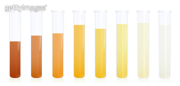 Urine samples, specimen test tubes with different colored urine ...