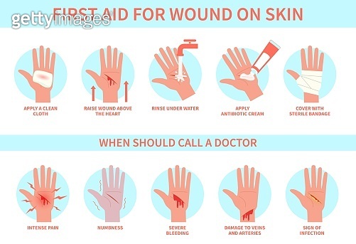 First aid for wound on skin. Damage, bleeding cut hand skin and ...