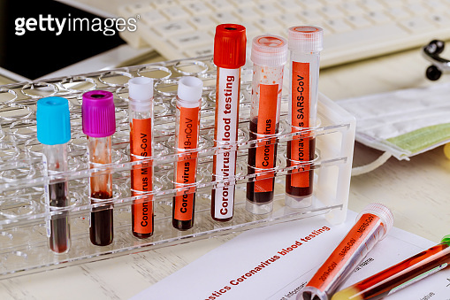 Test blood sample in collection tube with laboratory report atypical ...