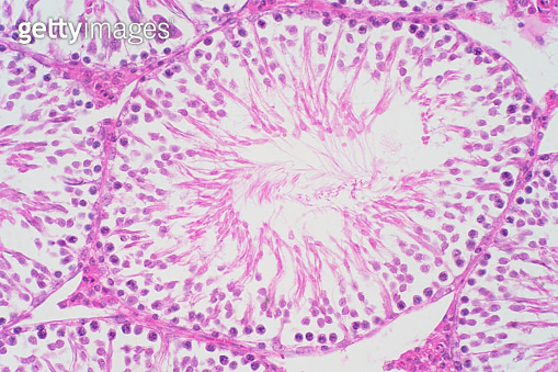 Human testis under the microscope view. Shows spermatogonia ...