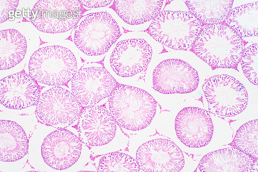 Human testis under the microscope view. Shows spermatogonia ...