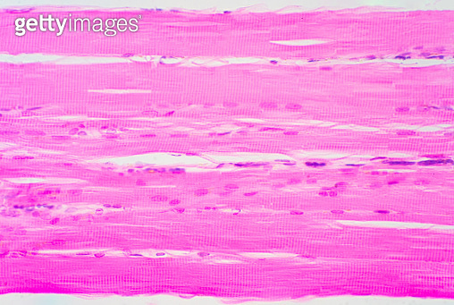 Human skeletal muscle under microscope view for education pathology ...