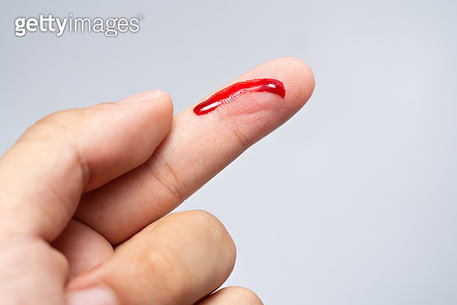 Bleeding blood from the cut finger wound. 이미지 (1224949084) - 게티이미지뱅크