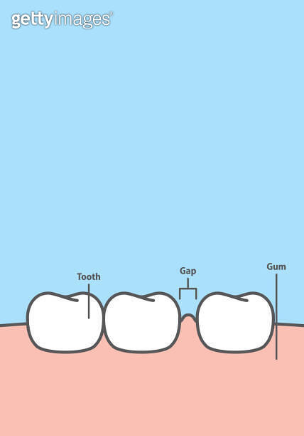 Blank banner Diastema teeth frame cartoon style for info or book ...