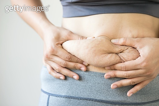 Pregnant women resulting in tummy skin, fat patterns and scars ...