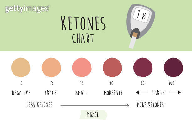 Ketogenic Reading Infographic Chart showing color coding for ketone ...