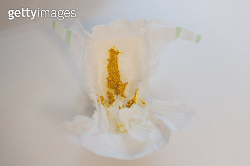 Baby diaper stained feces Newborn nappy dirty shit in toilet. 이미지 ...