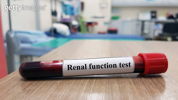 Laboratory sample of blood testing for diagnosis kidney disease ...