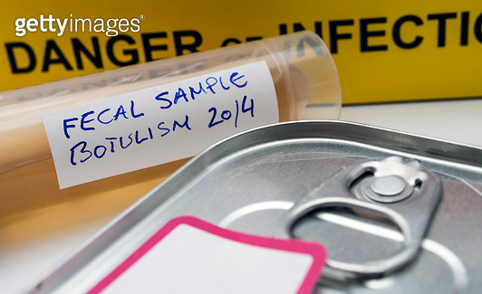 Canned food can contaminated by Clostridium botulinum toxin that causes ...