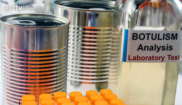 Several samples of tin cans, botulism infection in sick people ...