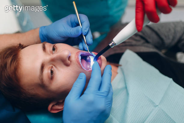 Dentistry. Dentist and patient. Light curing seal. UV dental lamp and ...