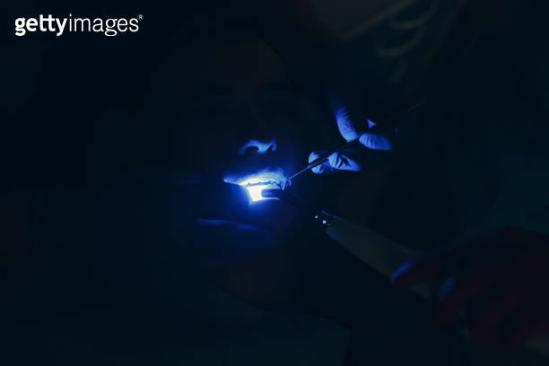 Dentistry. Dentist and patient. Light curing seal. UV dental lamp and ...