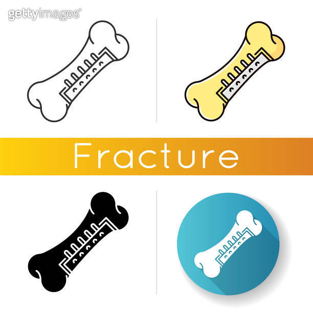 Repaired bone icon. Internal fixation. Surgery. Surgical procedure ...