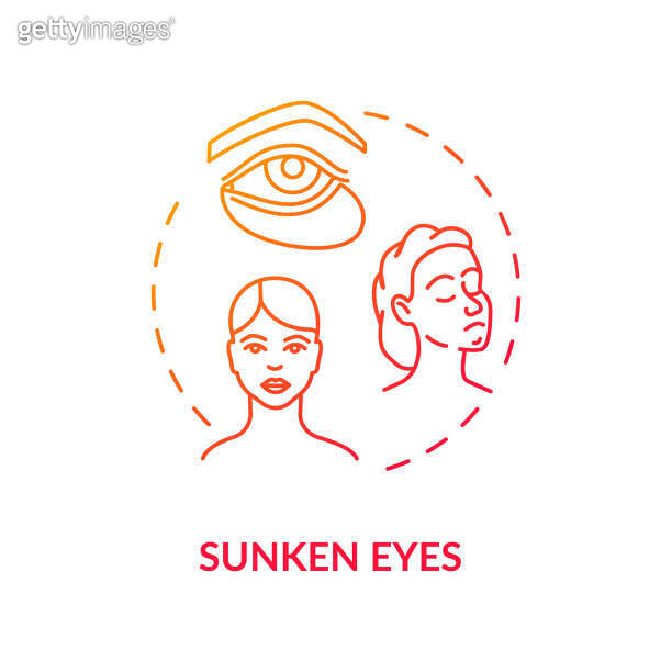 Sunken eyes red concept icon. Lack of sleep sign. Dark circles from ...