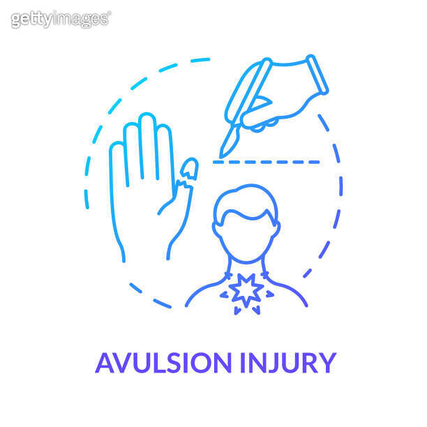Avulsion injury, finger deprivation concept icon. Trauma treatment ...
