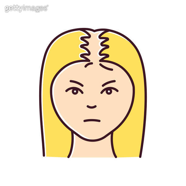 Female hair loss RGB color icon. Woman with alopecia. Hairloss problem ...