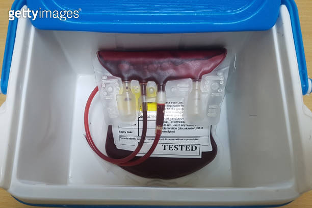 A unit of blood kept in a box before the procedure of blood transfusion ...