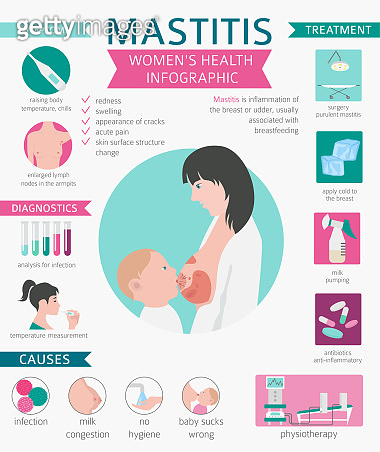 Mastitis, breastfeed, medical infographic. Diagnostics, symptoms ...
