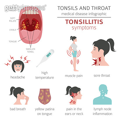 Tonsils and throat diseases. Tonsillitis symptoms, treatment icon set ...
