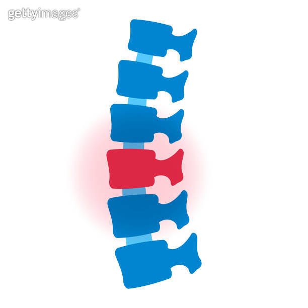 Flat vector illustration of problem with human spine silhouette ...