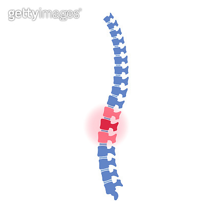 Flat vector illustration of problem with human spine silhouette ...