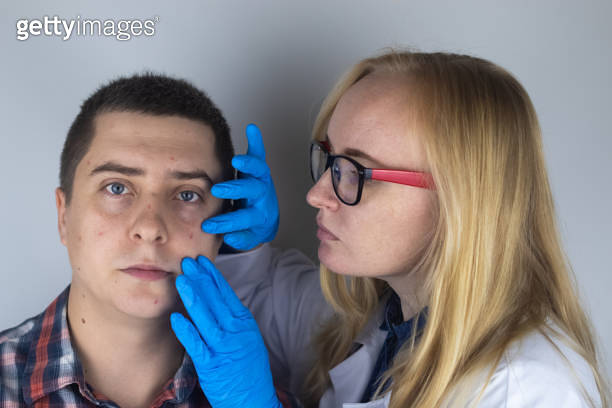 An allergist or dermatologist examines red spots on a man’s face. The ...