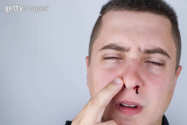 The man's nose started bleeding. High blood pressure caused blood ...