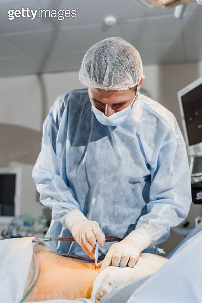 Surgeon removes fat in the gluteal region. Abdominoplasty - plastic ...