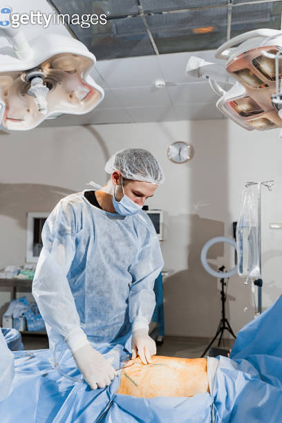 Abdominoplasty - plastic operation to reduce the abdomen and remove ...