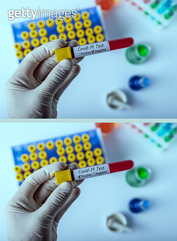 Covid-19 - diagnostic laboratory, test tube with blood of a patient ...