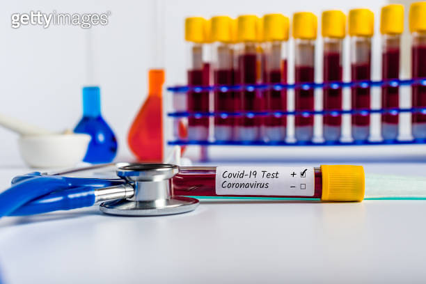 Covid-19 - test tube with blood of a patient with virus with positive ...