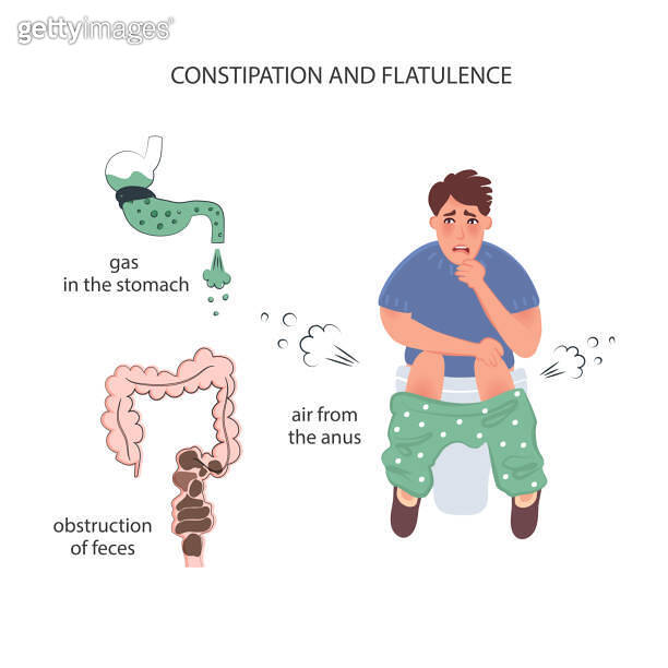 Constipation and flatulence in men. Air outlet through the anus. Gas in ...