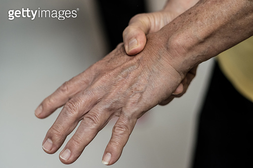 Tendinitis Overuse hand problems. Old man hand with red spot o fingers ...