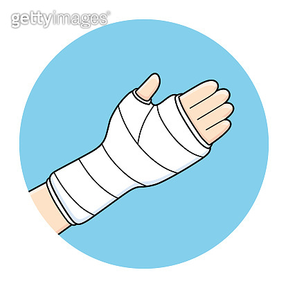 Broken arm, bone fracture, orthopedic plaster cast icon. (1281981737 ...