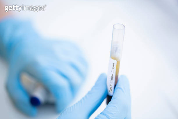 Doctor in Medical laboratory working test with medical samples using ...