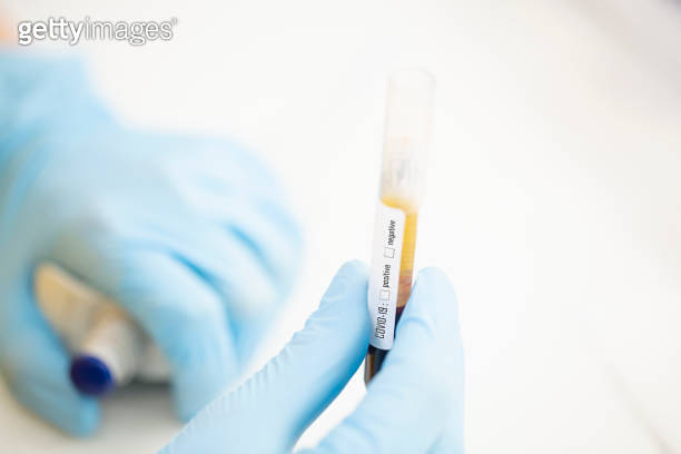 Doctor in Medical laboratory working test with medical samples using ...