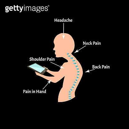 Improper posture symptoms. Text Neck Syndrome. Spinal curvature ...
