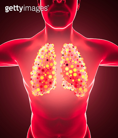 Human anatomy, problems with the respiratory system, severely damaged ...