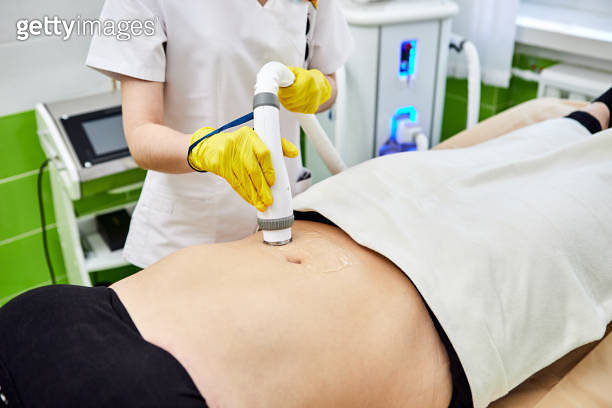 Rf skin tightening, belly. Hardware cosmetology. Ultrasound cavitation ...