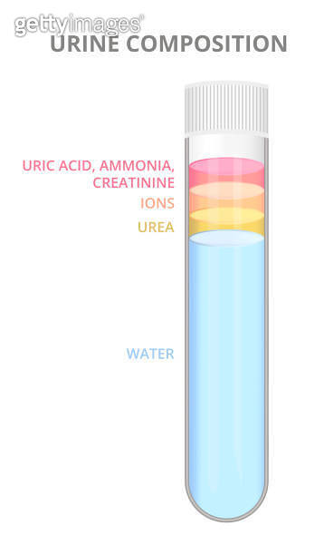 Urine composition, the composition of urine, urine components. Uric ...