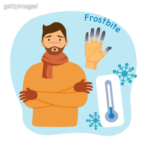 Man suffering from frostbite symptom. Guy with frozen hands in winter ...