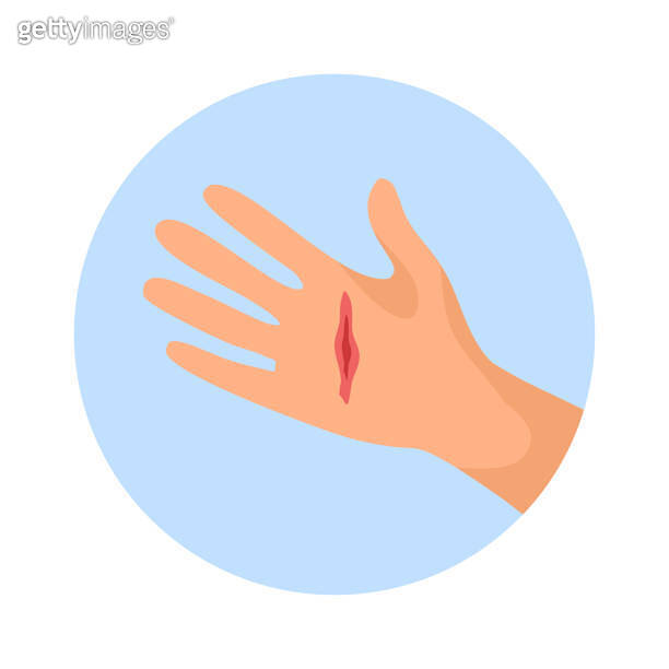 Cut injury with red blood on palm in flat design. Wound on hand concept ...