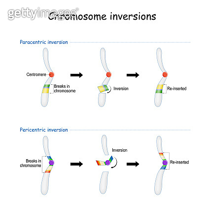 Chromosomal inversion. paracentric and pericentric. (1204246187) - 게티이미지뱅크