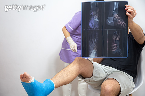 X-ray of a foot fracture close-up on a consultation with a doctor. 이미지 ...
