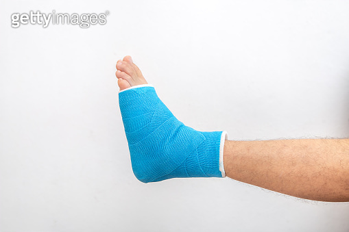 Man's leg in plaster cast and blue splint close up on white background ...