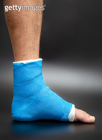 Close up photos of foot blue splint for treatment of injuries from ...