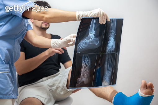 X-ray of a foot fracture close-up on a consultation with a doctor. 이미지 ...