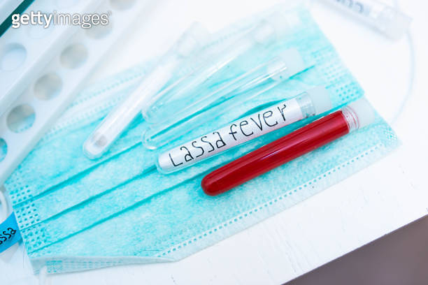 test Lassa fever in vitro in a laboratory. 이미지 (1206927724) - 게티이미지뱅크