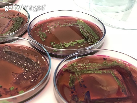 Escherichia coli (E.coli) cultured with Eosin Methylene Blue (EMB) Agar ...