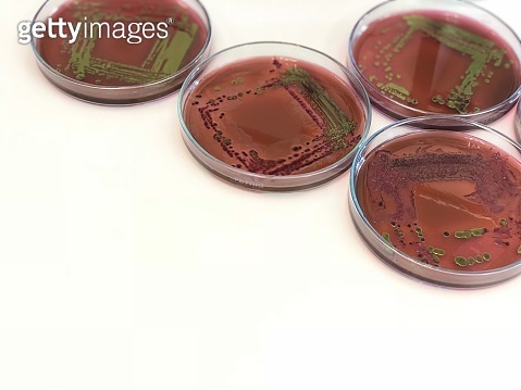 Escherichia coli (E.coli) cultured with Eosin Methylene Blue (EMB) Agar ...